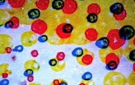What is Roller Printing | Common Defects of Roller Printing