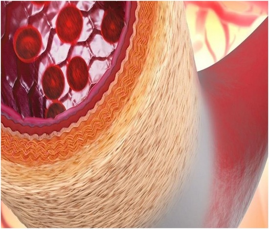 Medical Textiles in Bangladesh: Significance and Future Prospect